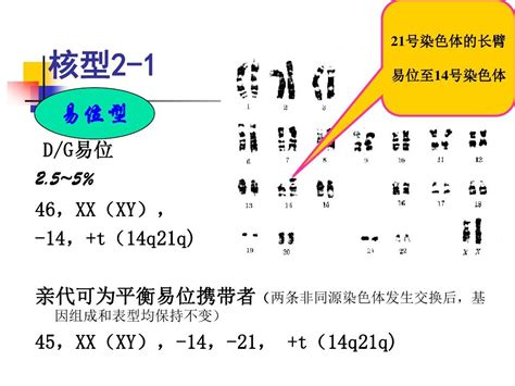唐氏筛查 21三体综合征 Word文档在线阅读与下载 无忧文档