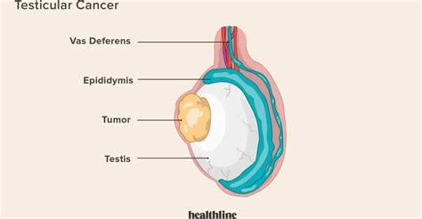 What Is Testicular Cancer Medicine For World