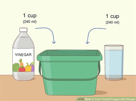 How To Cure Toenail Fungus Can Vinegar Help