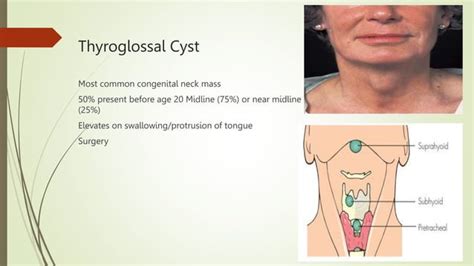 Neck Exam Pptx Cervical Lymph Node Examination Pptx