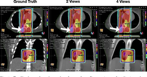 Figure 5 From Ct Reconstruction From Few Planar X Rays With Application Towards Low Resource