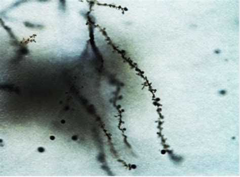 Neuroscientists Find Promise In Intervention To Normalize Biological Functions In Fragile X Mice