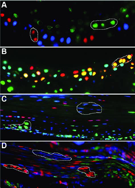 Clonal Maintenance In Mesoderm Derived Limb Tissues Clones Within