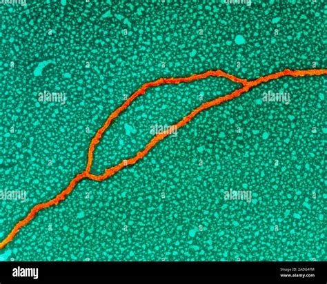 Dna Replication Coloured Transmission Electron Micrograph Tem Of