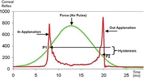 Other Diagnostic Imaging Tools For Keratoconus Ento Key