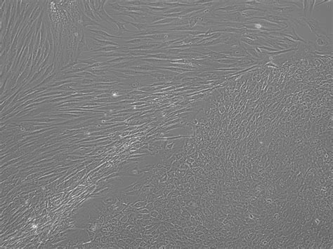 How To Isolate Keratinocytes From Fibroblasts In A Co Culture Using Medium Researchgate