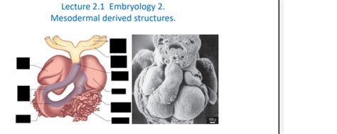 Lecture 21 Embryology 2 Mesodermal Derived Structures Flashcards