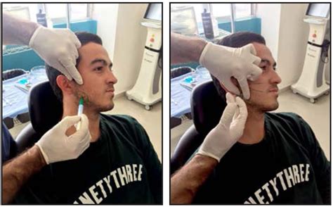 Comparison Of Neuromuscular Deprogramming Options