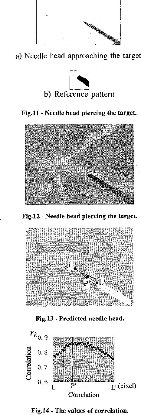 Table I From Automatic Microinjection System Using Stereoscopic Microscope Semantic Scholar
