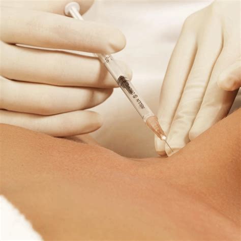 Hyperhidrosis Injection Dubai Excessive Sweating Treatment