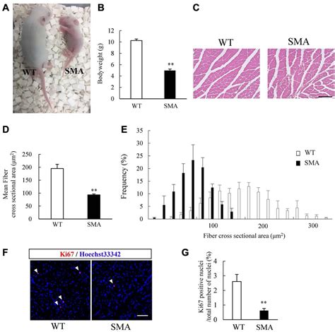 Smn Protein Contributes To Skeletal Muscle Cell Maturation Via Caspase 3 And Akt Activation In