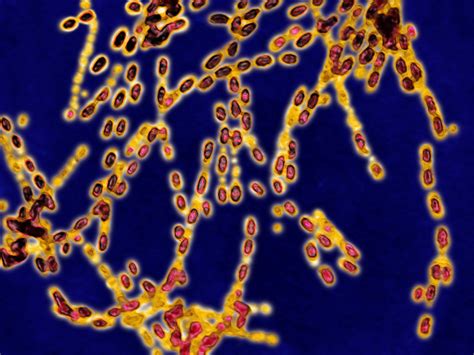 Cdc Anthrax Exposure May Have Affected 75 Staffers Time