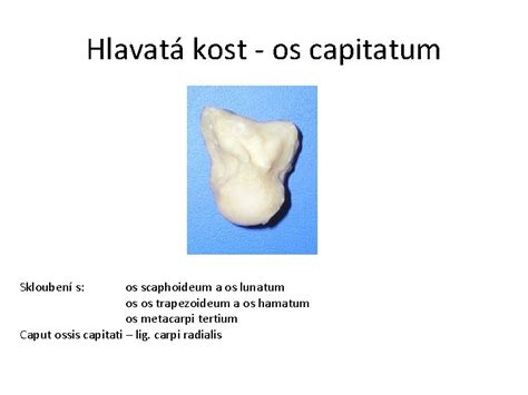 Kosti Ruky Ossa Manus Ossa Manus 1 Distal