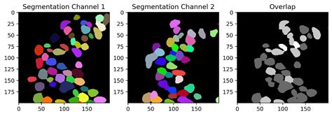 Count Overlapping Nuclei Image Analysis Imagesc Forum