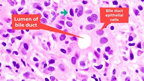 Bile Duct Histology