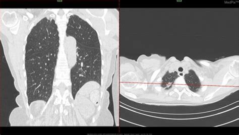 Types Of Scans Make Nds Count