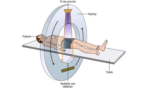 How Ct Scans Work And Why They Matter