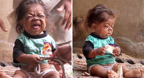 Meet The 25 Year Old Man Who Has Stopped Growing But Is Worshiped As A