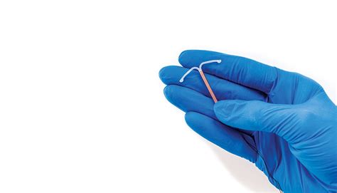 Coding For Contraceptive Procedures And Devices Aapc Knowledge Center