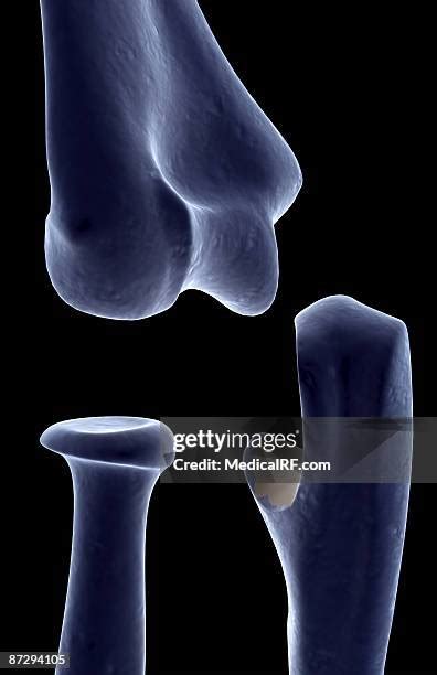 Olecranon Fossa Photos And Premium High Res Pictures Getty Images