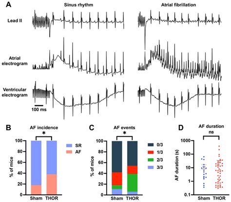 A Representative Ecg Tracings Showing Sinus Rhythm Left And Af Download Scientific Diagram