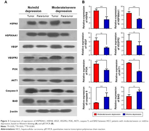 Expression Of Hsp90aa1 Hspa8 In Hepatocellular Carcinoma Patients With