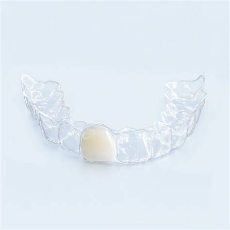 Missing Tooth Retainer Instant Smile Fix Venneir®