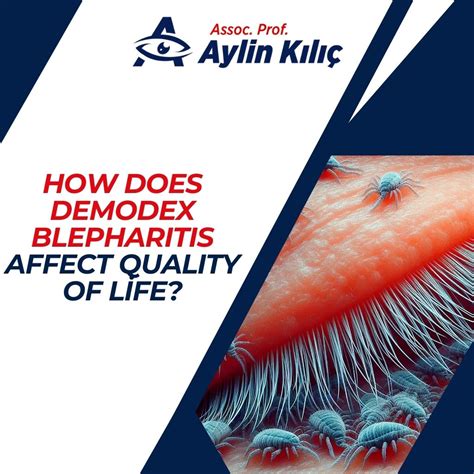 How Does Demodex Blepharitis Affect Quality Of Life Home