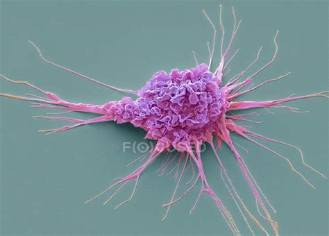 Colored Scanning Electron Micrograph Of Protective Dendritic Cell Of