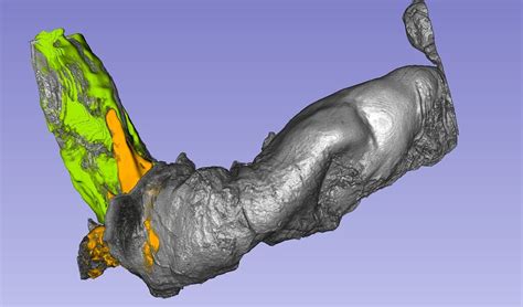 Removing 3d Model To View Segmentation Support 3d Slicer Community