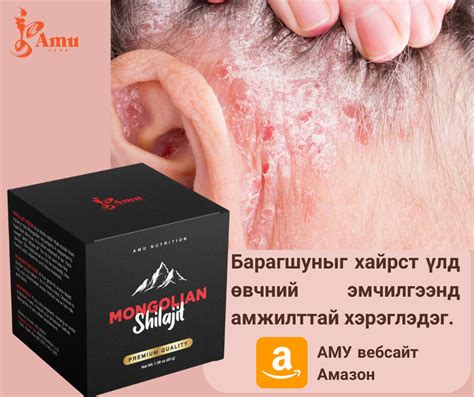 Amu Usa БАРАГШУН НЬ МАШ ОЛОН ӨВЧНИЙ ЭМЧИЛГЭЭНД ХЭРЭГЛЭГДДЭГ БИЛЭЭ ӨНӨӨДӨР НЭГЭН ХҮНИЙ