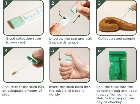 Stool Routine Examination Pptxstool Routine Examination Pptx