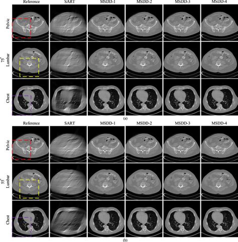 Images Reconstructed From Msddrnet With Different Msdd Modules For Download Scientific Diagram