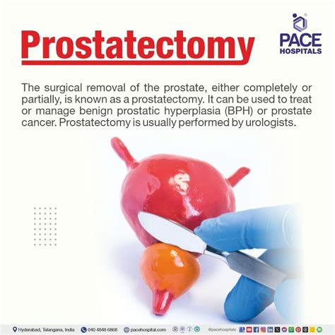 Best Hospital For Prostatectomy Surgery In Hyderabad India