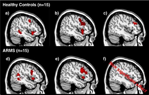 statistical parametric maps during a response initiation n word