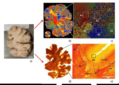 mueller polarimetric imaging to improve neurosurgery laboratoire de