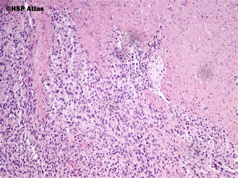 Hsp Atlas Histopathology Atlas