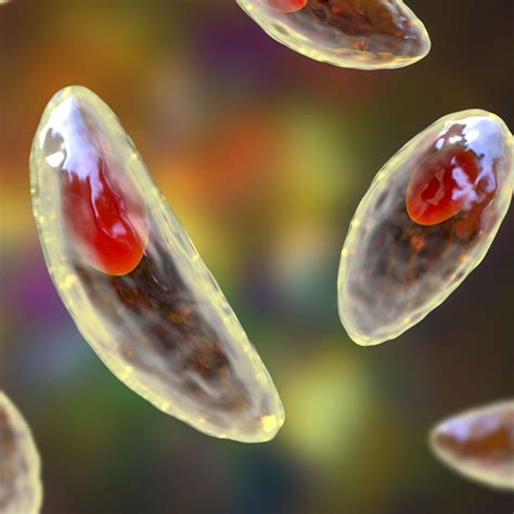 How To Get Rid Of Flukes In Humans