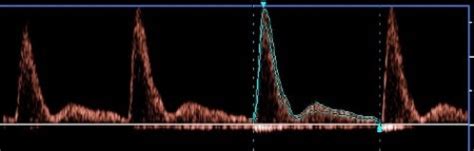 Doppler Health New Zealand Te Whatu Ora