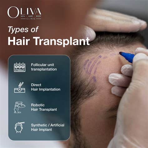 Types Of Hair Transplant Techniques Fue Dhi Fut Explained