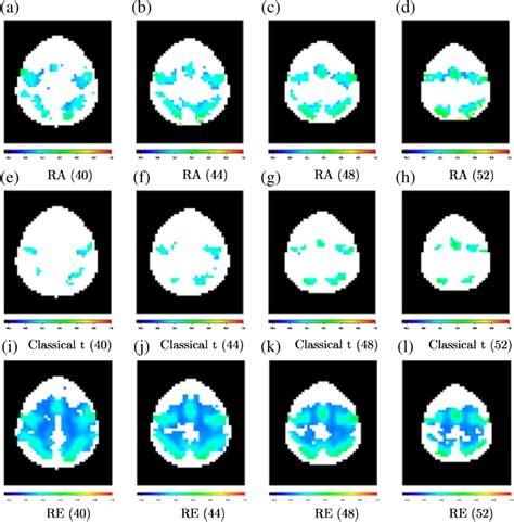 Comparison Of Activation Maps For Four Slices Z 40 44 48 And 52