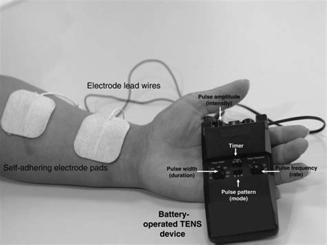 References In Transcutaneous Electrical Nerve Stimulation Continuing