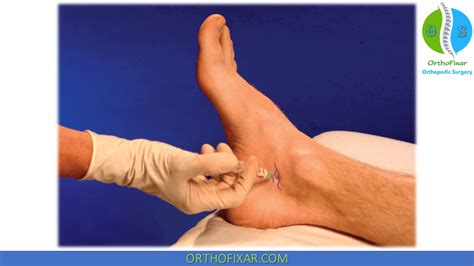 Foot Joint Injection Cpt Code At Joanne Gonzalez Blog