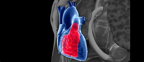 Comparing Left Ventricular Shape Across Mesa
