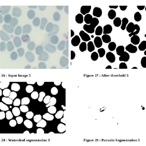 pdf malaria detection using image processing and machine learning