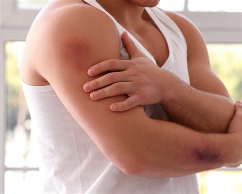 Skin Concerns Healthone Skin Clinic