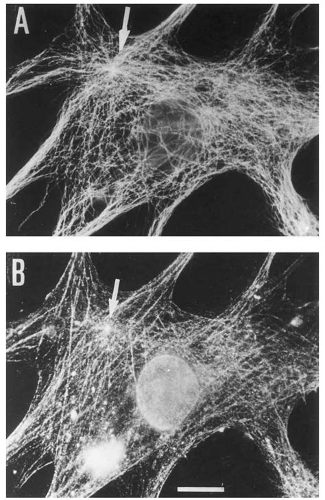 Immunofluorescence Pattern Showing The Localization Of