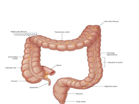 SOLUTION: 20 colon and rectum final version - Studypool