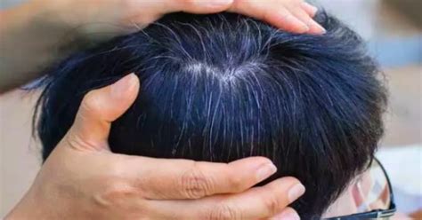 Grey Hair গজিয়ে উঠেছে দু চারটে পাকা চুল আড়াল করুন এই উপায়ে