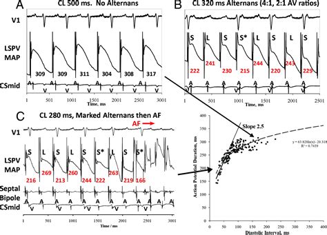 Repolarization Alternans Reveals Vulnerability To Human Atrial